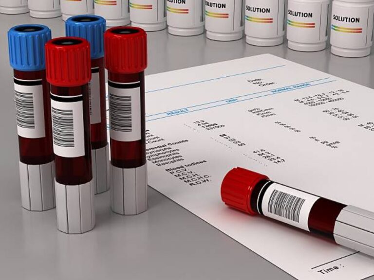 Understanding Your Blood Results – Friendly Smiles Foundation